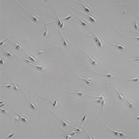 Characteristics And Image Of A Healthy Sperm Conceive Plus®