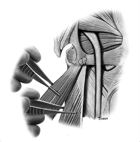 Anatomy Of Hamstring Origin The Conjoint Tendon Is Formed For Long