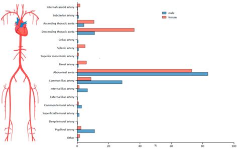 Arterial Aneurysm Localization Is Sex Dependent Pmc