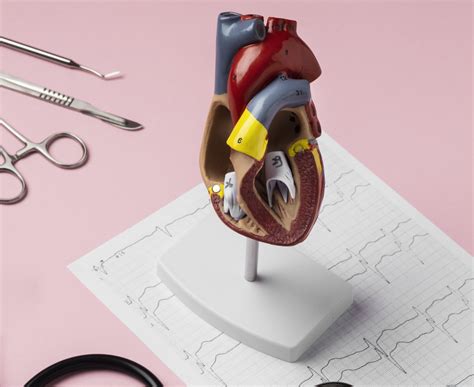 What Is Atrial Fibrillation More Than Medication
