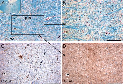 Histologically Normal Omnipause Neurons Omnipause Neurons In The Download Scientific Diagram