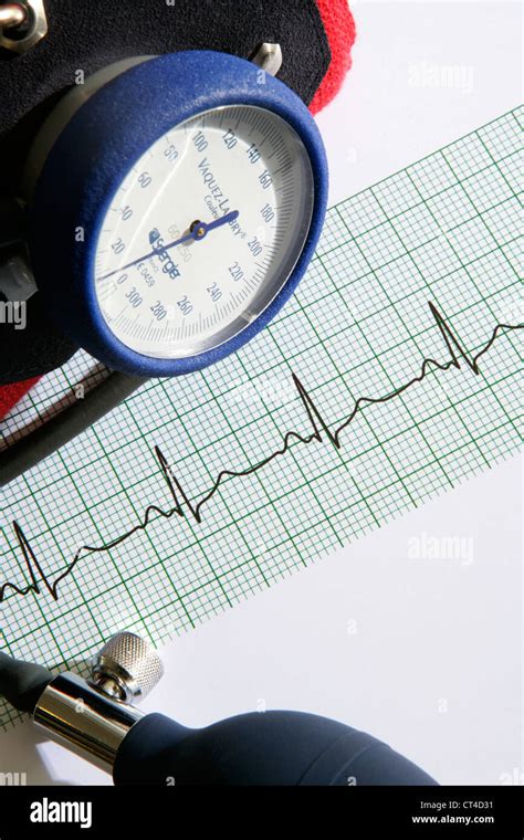 Normal Ecg Hi Res Stock Photography And Images Alamy