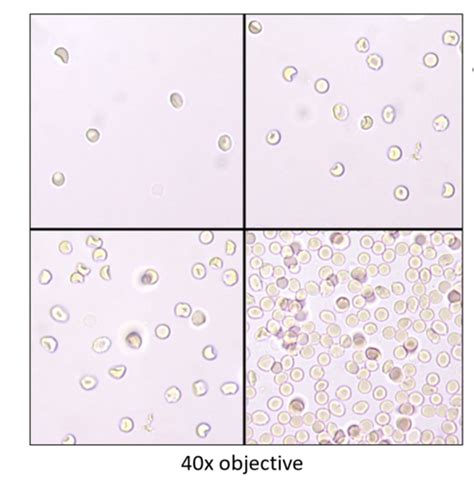 Learning Sediment Urine Flashcards Quizlet