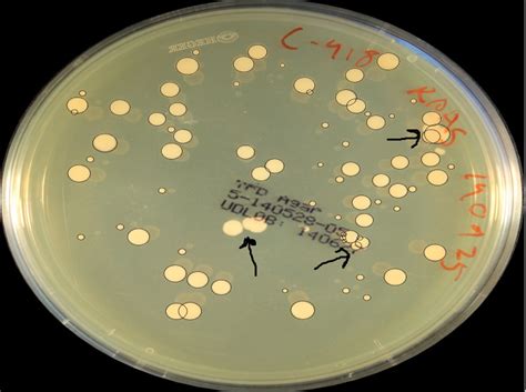 Detect Contour With Mask Opencv Qanda Forum