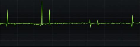 The Basic Waveforms In Synthesis On The Track