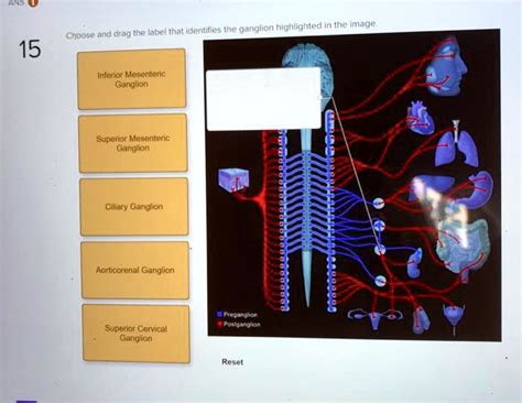Solved Choose And Drag The Label That Identifies The Ganglion Highlighted In The Image 15