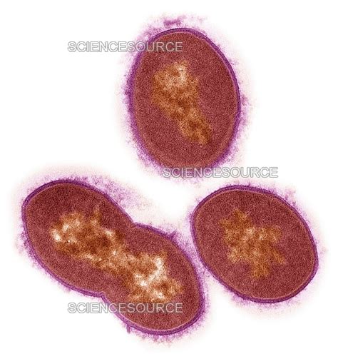 Streptococcus Bacteria Tem Stock Image Science Source Images