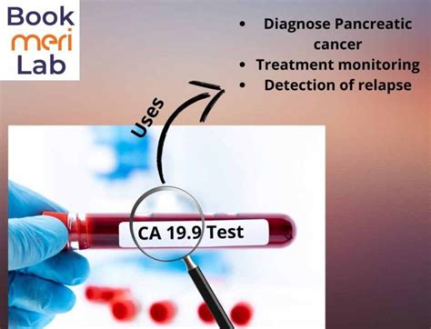 Ca 19 9 Test Price Purpose Range And Results [2025] • Bookmerilab
