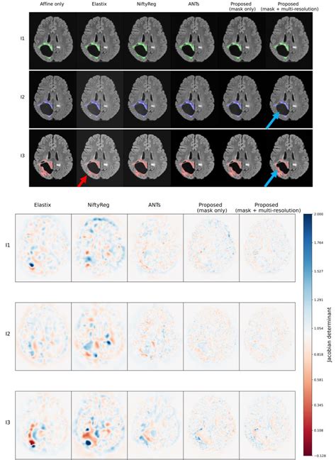 Figure 3 From Deep Learning Based Group Wise Registration For Longitudinal Mri Analysis In