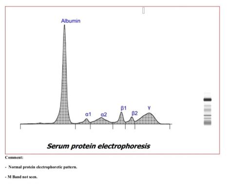Serum Protein Electrophoresis Introduction Pattern Application