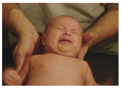 Gentle Direct Stretching Of Hypertonic Or Restricted Myofascial