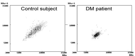 Hrv Poincaré Plots Illustrate Differences In Beat To Beat Heart Rate Download Scientific