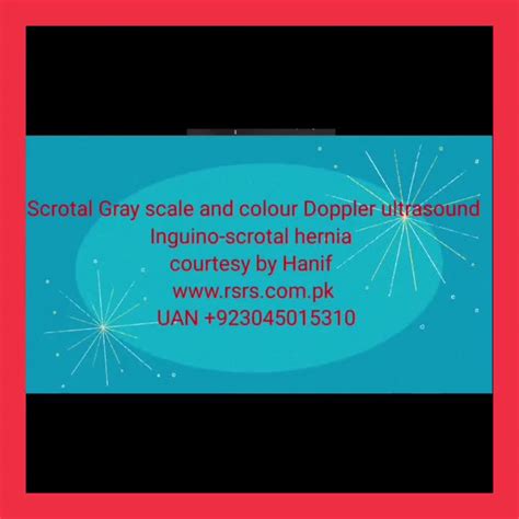 Rabbani School Of Radiology And Sonology Rsrs On Linkedin Hello 👋 Everyone This Is The Scrotal