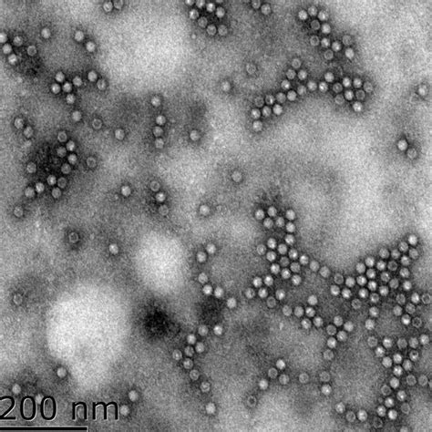 Electron Micrograph Of Recombinant Avian Adenoassociated Virus Download Scientific Diagram