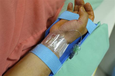 Uterine Fibroid Embolization Procedure Transradial Transfemoral