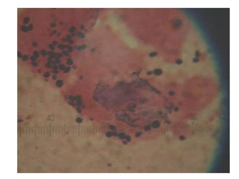 Cryptococcus PPTX