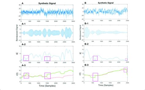 A Synthetic Eeg Signal Generated At A F S 250hz With A Snr Of
