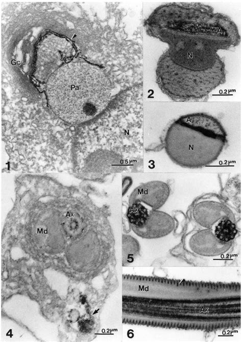 Figure 13 From Ultrastructural Localization Of Enzymatic Activity During Spermiogenesis In Two