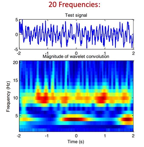 BME EEG Analysis Wavelet Transform Aursus