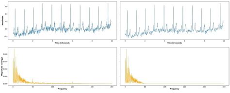 Spectrogram For Ecg Id 1 Lead I Unfiltered Vs Filtered Signal Download Scientific Diagram
