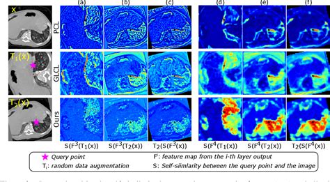 Figure 1 From Keypoint Augmented Self Supervised Learning For Medical Image Segmentation With