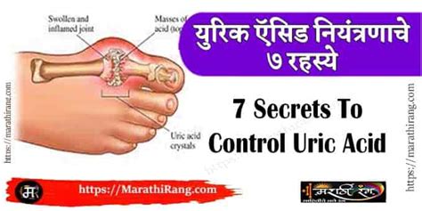 7 Secrets To Control Uric Acid यरक ऍसड Marathi Rang