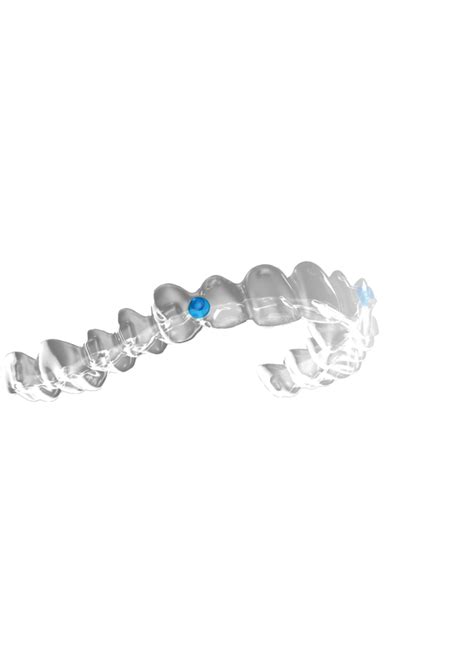 Angel Aligners Clear Aligners Nz Eden Orthodontics