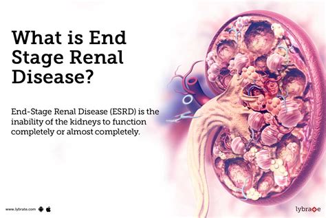 End Stage Renal Disease Causes Symptoms Treatment And Cost