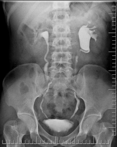 Chapter 7 Urinary System Flashcards Quizlet