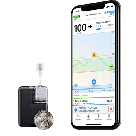 Geräte Finder Tandem Mobi Vs Insulin Pen Diabeteswise