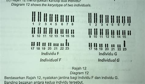 Diagram 12 Shows The Karyotype Of Two Studyx
