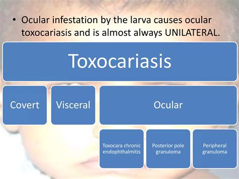 Toxocariasis Pdf