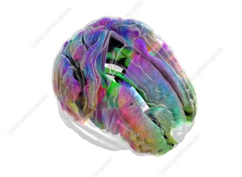 White Matter Fibres Dti Mri Scan Stock Image C0581561 Science