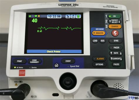 Transcutaneous Pacing Uab Clinical Simulation