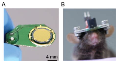 수면 질환·알츠하이머·파킨슨→뇌 질환 치료 길 열어