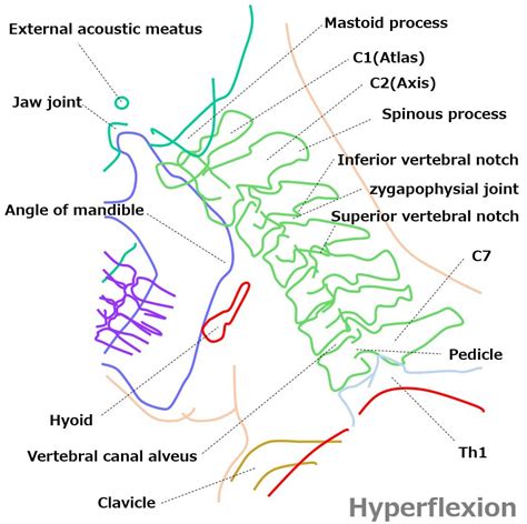 Cervical Spine Hyperflexion And Hyperextension View｜tools For Radtech