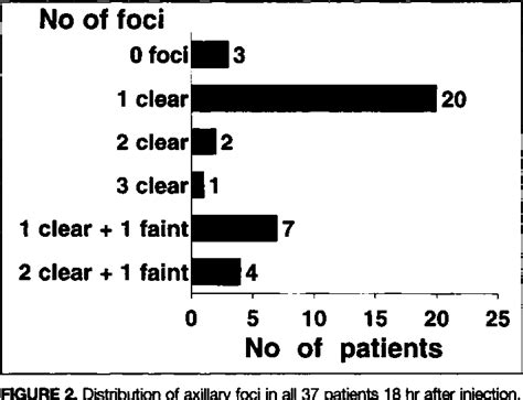 Figure 3 From Impact Of Lymphoscintigraphy On Sentinel Node