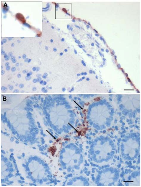 Detection Of Influenza Virus Antigen In Extrapulmonary Tissues 2 4 Days Download Scientific