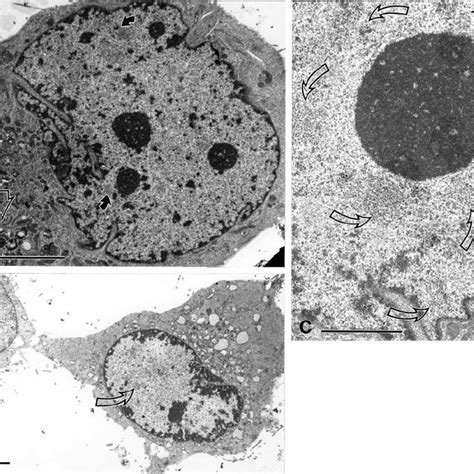 Rt4 Cells Have Been Exposed To Media For 1 2 4 Or 6 H A These Download Scientific Diagram