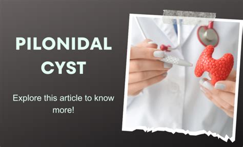 Pilonidal Cyst Signs Symptoms And Easy Prevention