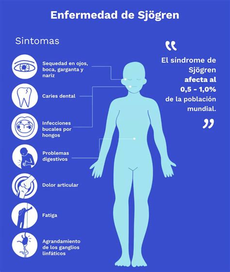 Enfermedad De Sjögren Tengo Sequedad En Ojos Boca Y Otras Partes Del