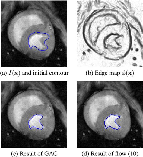 Figure 1 From Directional Geodesic Active Contours Semantic Scholar