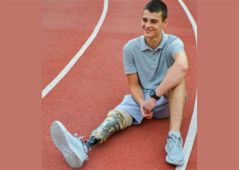 Безкоштовне протезування для військових та цивільних