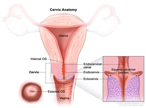 [figure Anatomy Of The Cervix The ] Pdq Cancer Information Summaries Ncbi Bookshelf