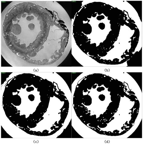 Automated Segmentation Results A Transversal Slice Through The