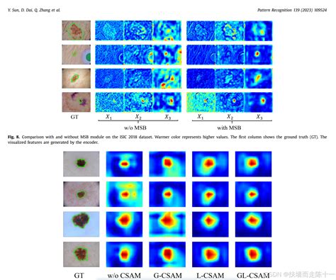 Msca Net Multi Scale Contextual Attention Network For Skin Lesion Segmentationmscanet Csdn博客