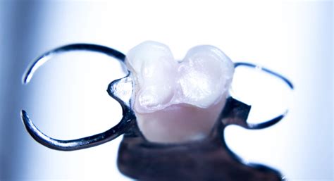 Partial Denture One Tooth