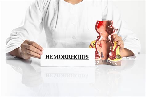 External Hemorrhoids Types Causes Diagnosis Treatment Meril Life