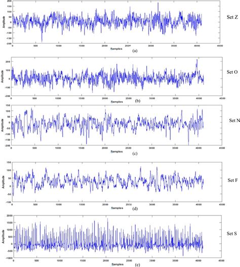 Automated Diagnosis Of Epileptic Seizures Using Eeg Image Representations And Deep Learning Bohrium