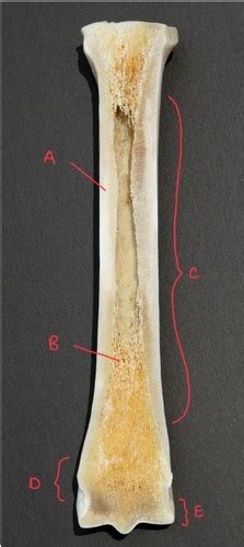 Nmsk Week 2 Bone Cartilage And Joints Flashcards Quizlet
